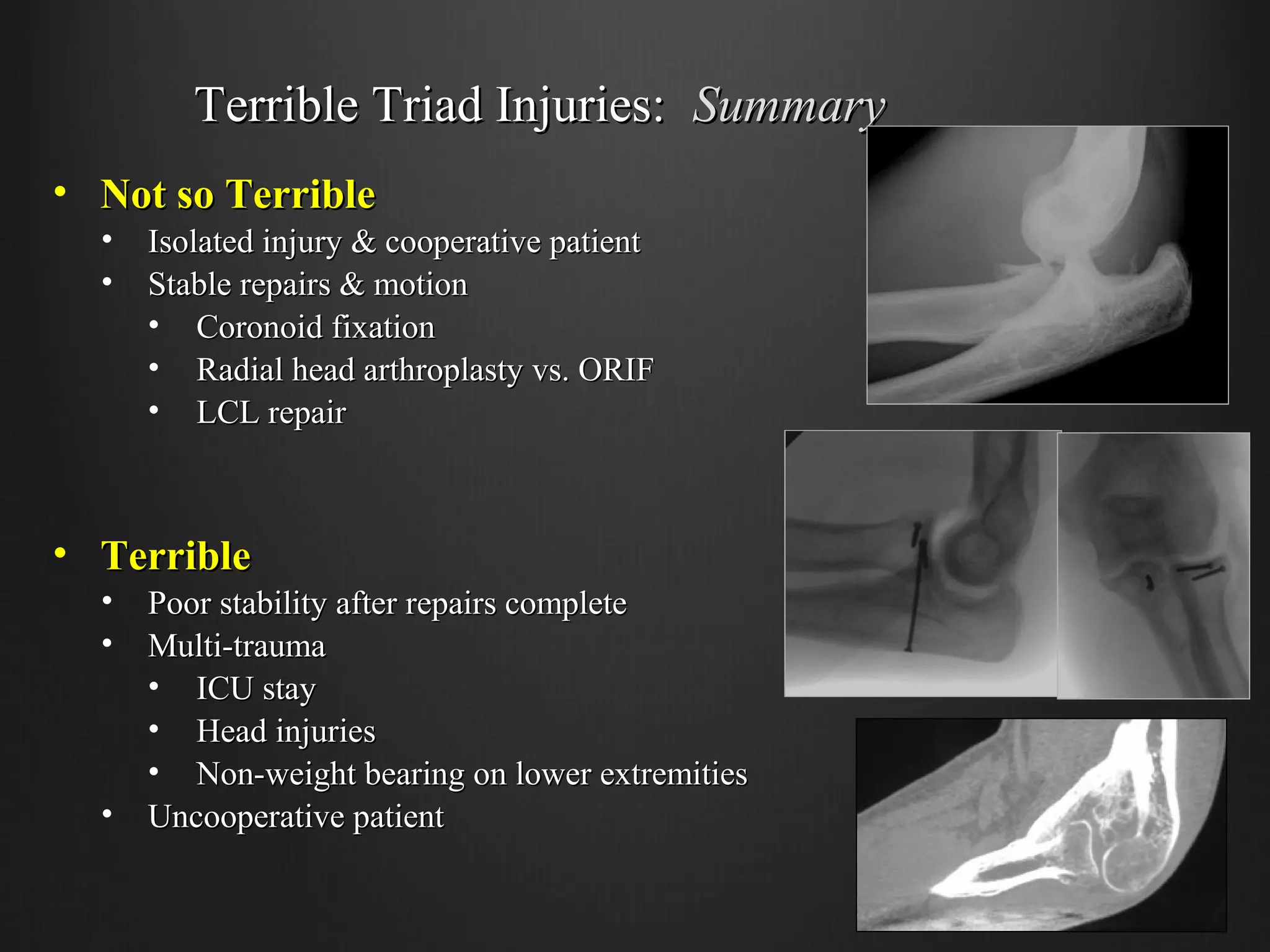 Terrible triad injuries - Hussain Algawahmed | PPT