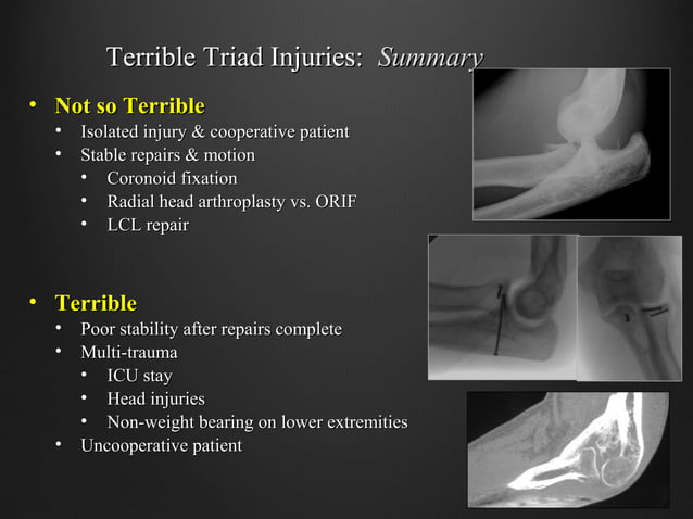 Terrible triad injuries - Hussain Algawahmed | PPT | Death, Injury, or ...