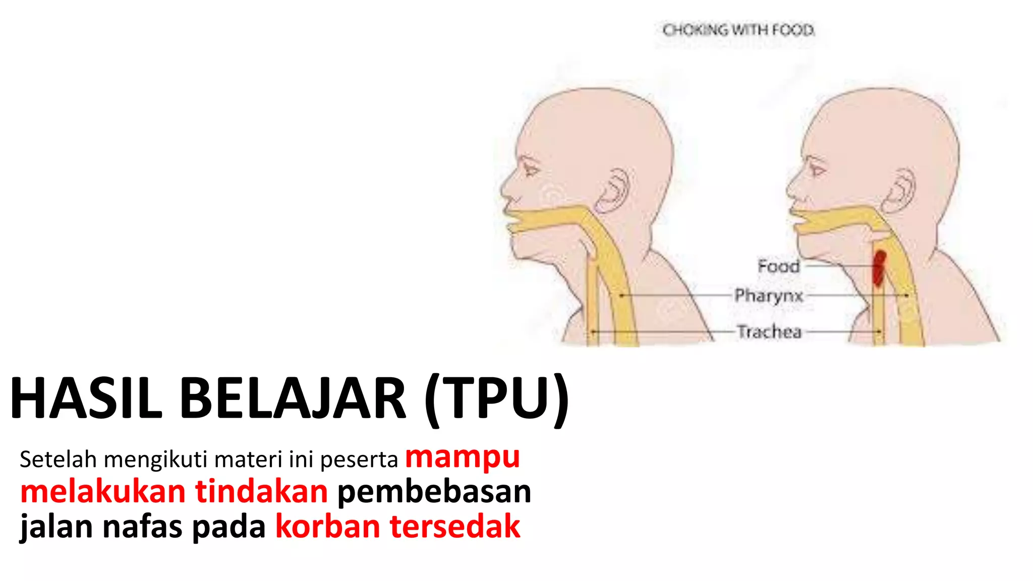 TERSEDAK.pptx