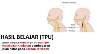 TERSEDAK.pptx
