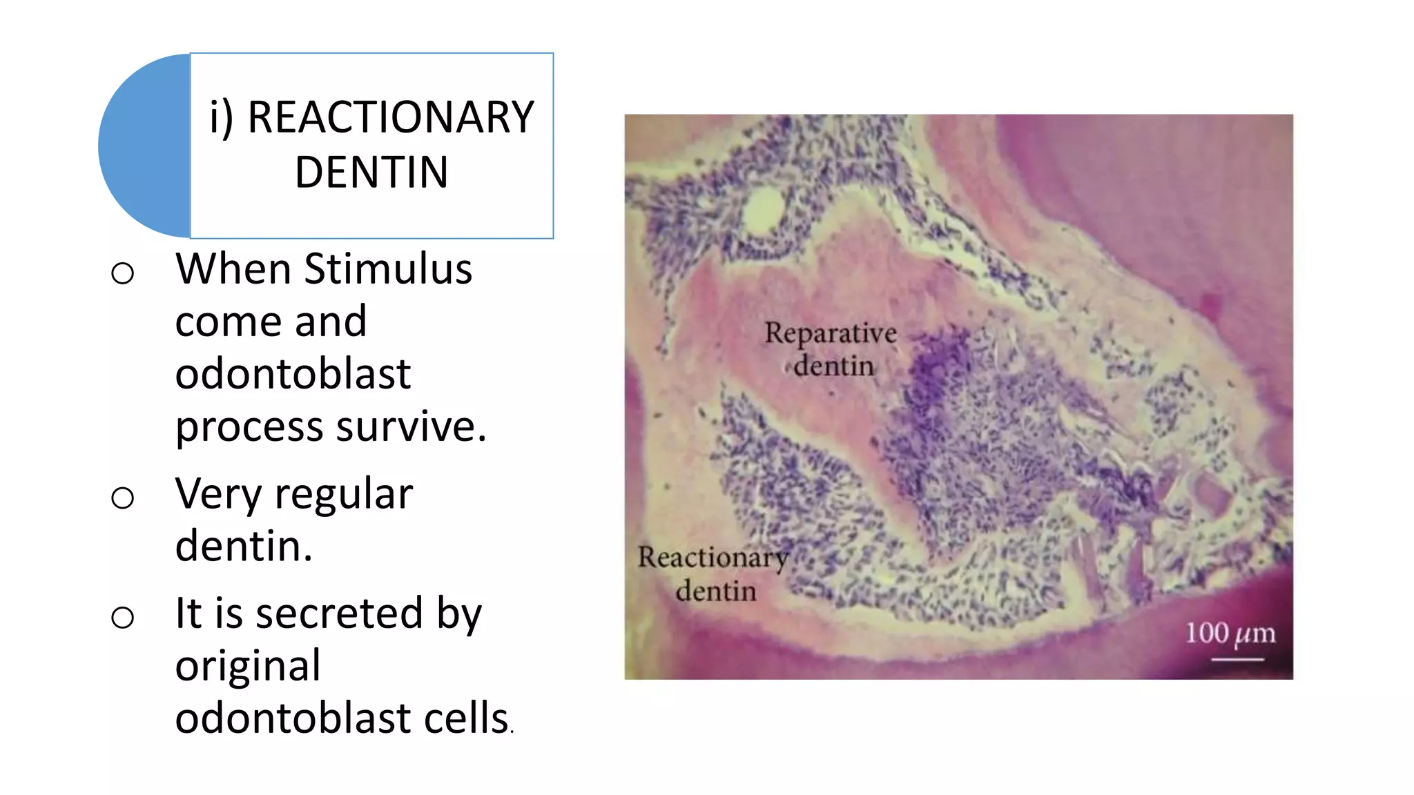 tertiary dentin.pptx