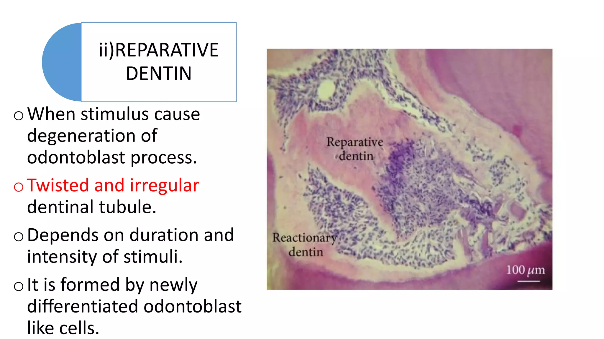 tertiary dentin.pptx
