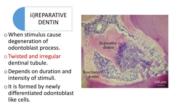 tertiary dentin.pptx | Dental Health | Diseases and Conditions
