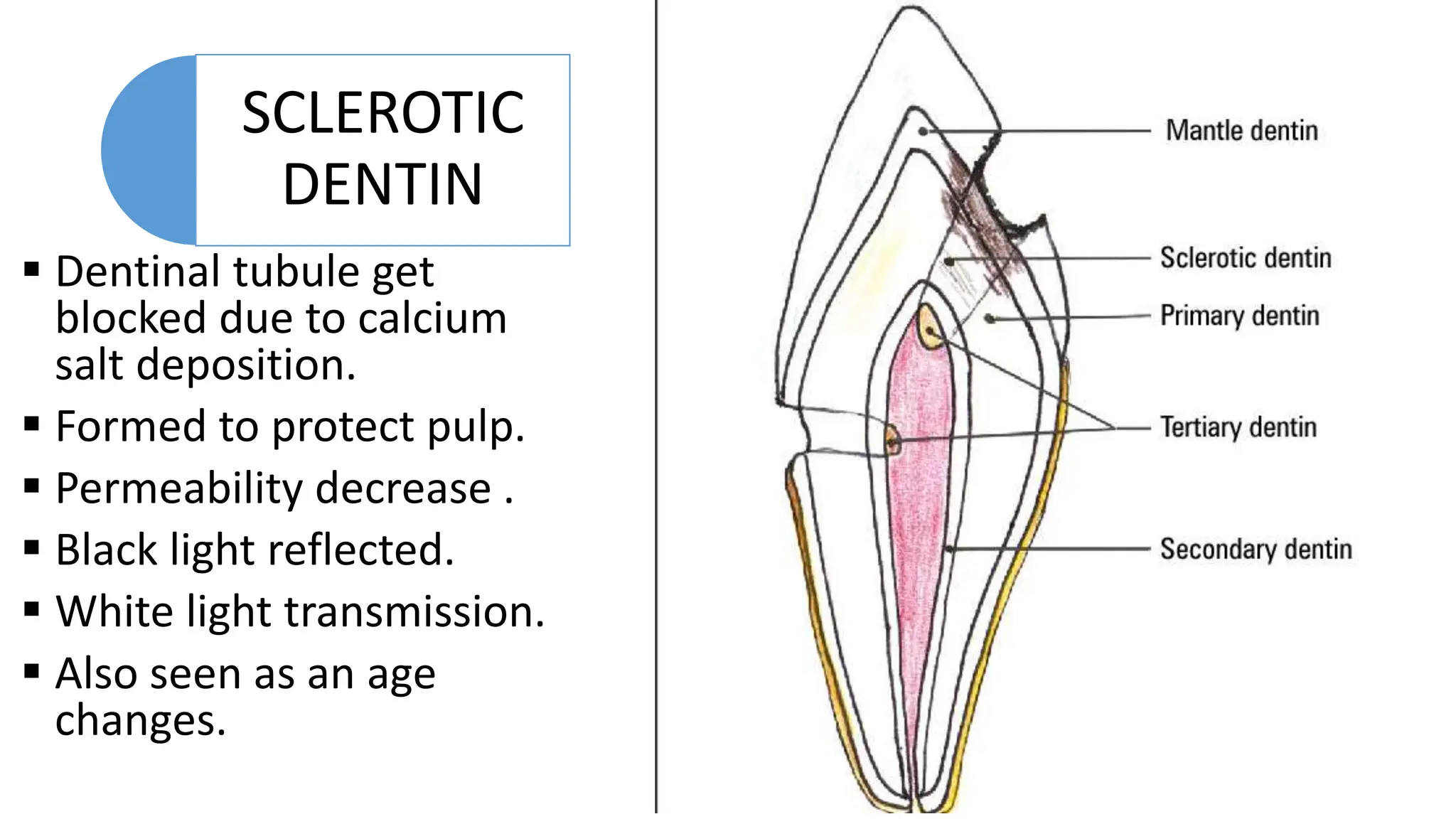 tertiary dentin types of tertiary dentin and histology | PPT