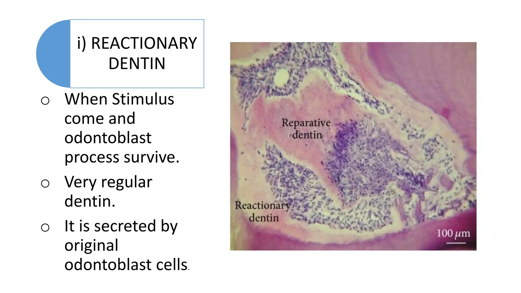 tertiary dentin types of tertiary dentin and histology | PPTX