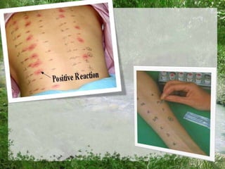 Tes alergi | PPTX