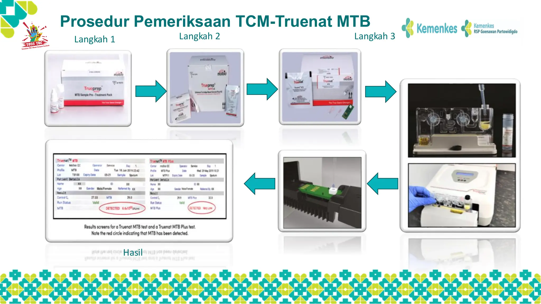 TES CEPAT MOLEKULER (TCM) UNTUK DIAGNOSIS TB.pdf