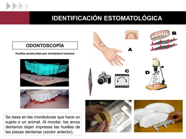 Identificación Forense a partir de los Tejidos Duros: Registros Denta…