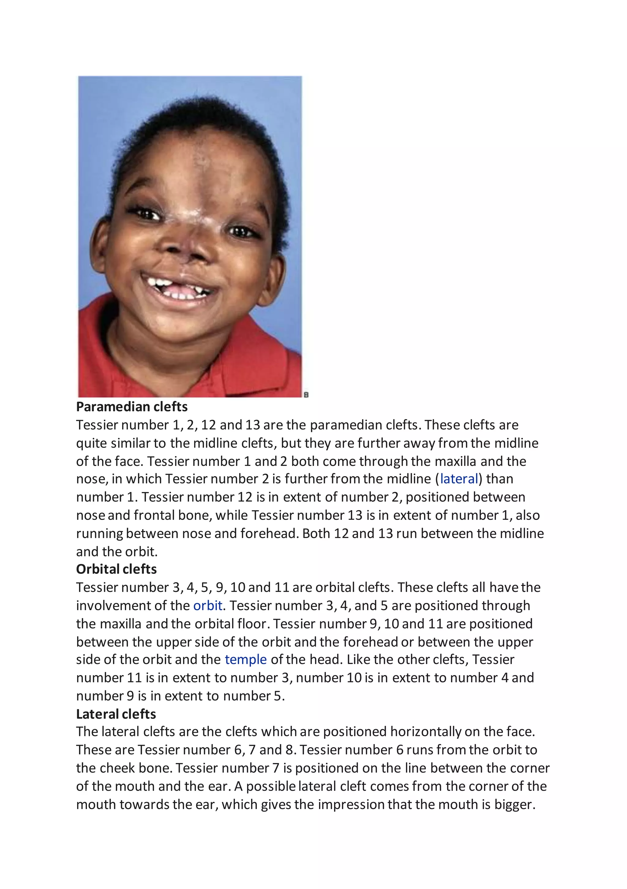 Tessier classification for orthodontist by Almuzian | DOCX