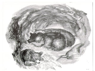 Test C.A.T. | PPT | Medical Tests | Medical Health