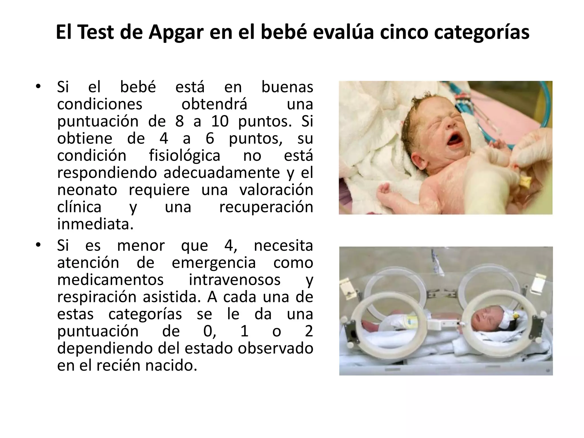 Test de apgar | PPTX