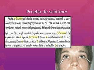 Test de schirmer para síndrome de ojo seco | PPTX