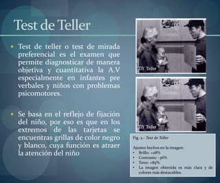 Test de teller | PPTX