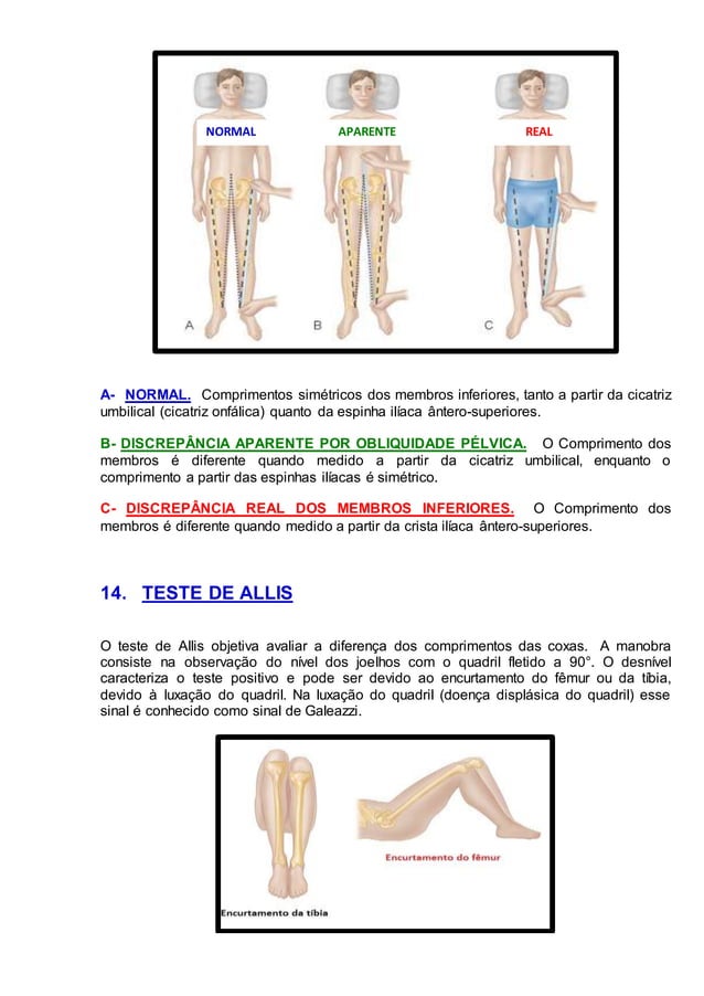 Testes especiais de coluna lombar e pelve em Fisioterapia | DOCX