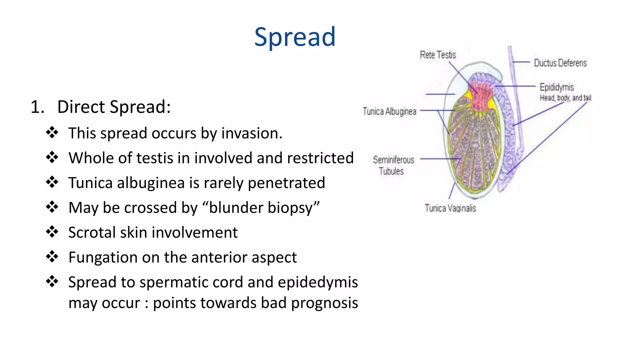TESTICULAR CANCERS | PPTX