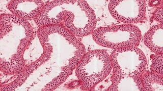 Testes pathology | PPTX