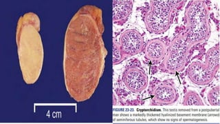 Testes pathology | PPTX