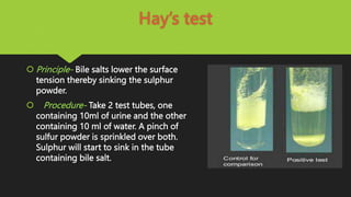 Test for ketone bodies, bile salts and.pptx