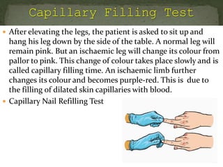 Test for peripheral arterial and venous circulation | PPTX