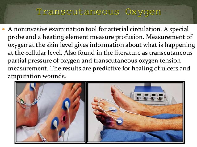 Test for peripheral arterial and venous circulation | PPTX