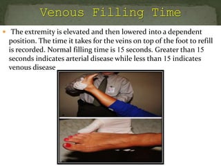 Test for peripheral arterial and venous circulation | PPT