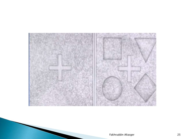 Test for stereopsis | PPTX | Eye and Vision Conditions | Diseases and ...