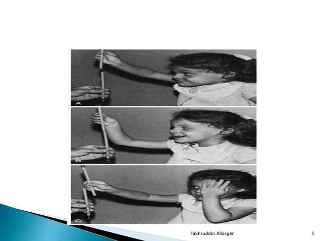 Test for stereopsis | PPTX | Eye and Vision Conditions | Diseases and ...