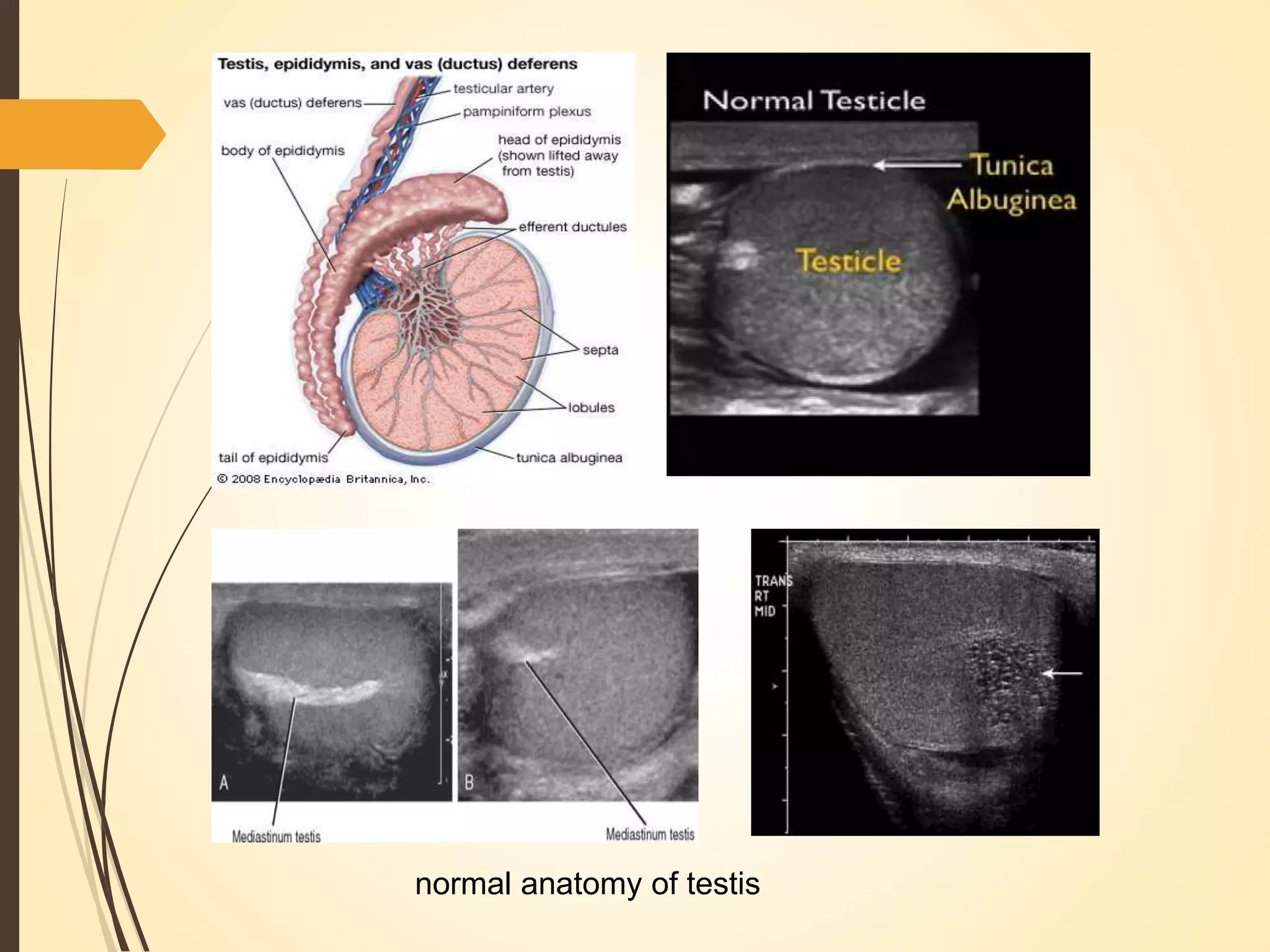 imaging of Testicular malignancies | PPTX