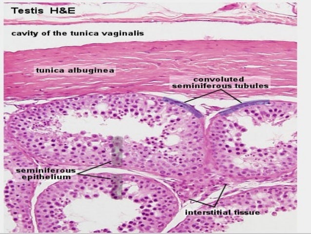 Testicular biopsy slides