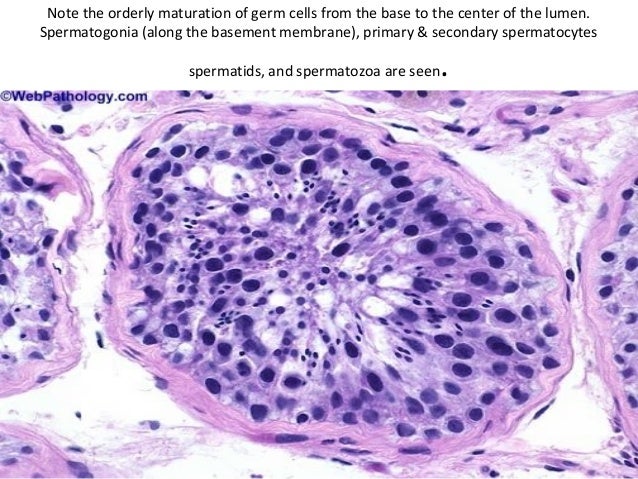 Testicular Biopsy Slides
