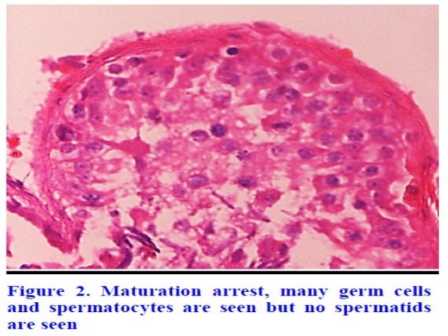 Testicular Biopsy Slides
