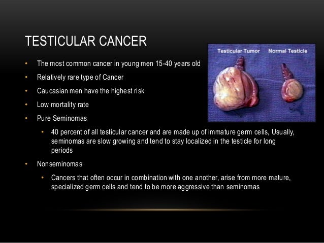 Testicular cancer