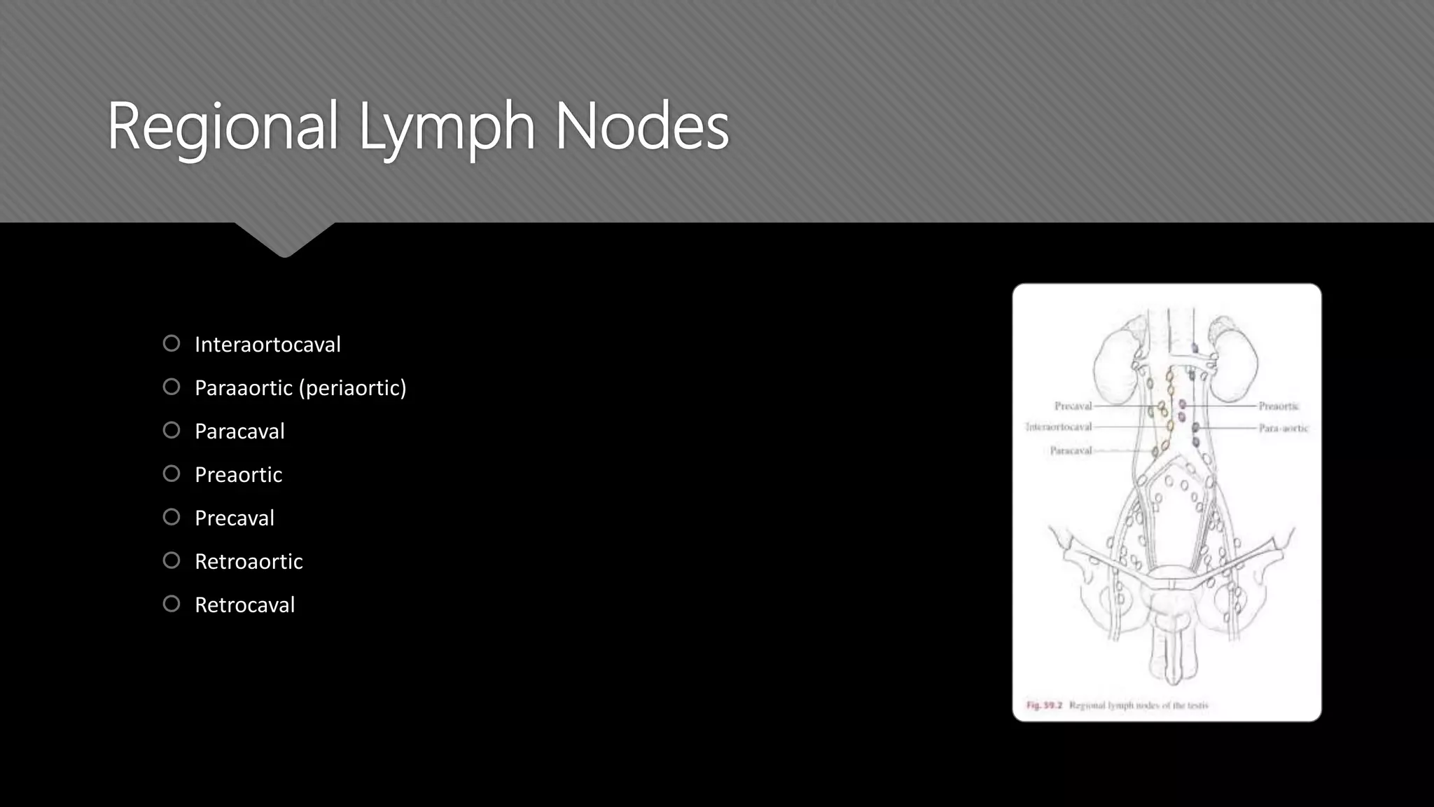 Testicular cancer | PPTX