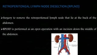 Testicular cancer | PPTX