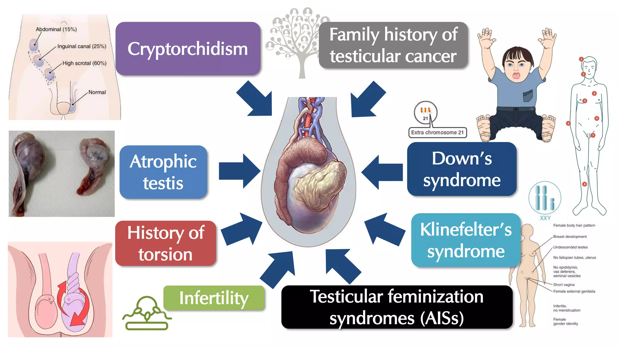 Testicular cancer | PPT