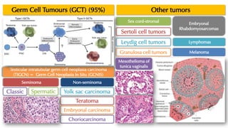 Testicular cancer | PPT