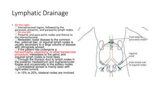 Testicular cancer.pptx | Cancer | Diseases and Conditions