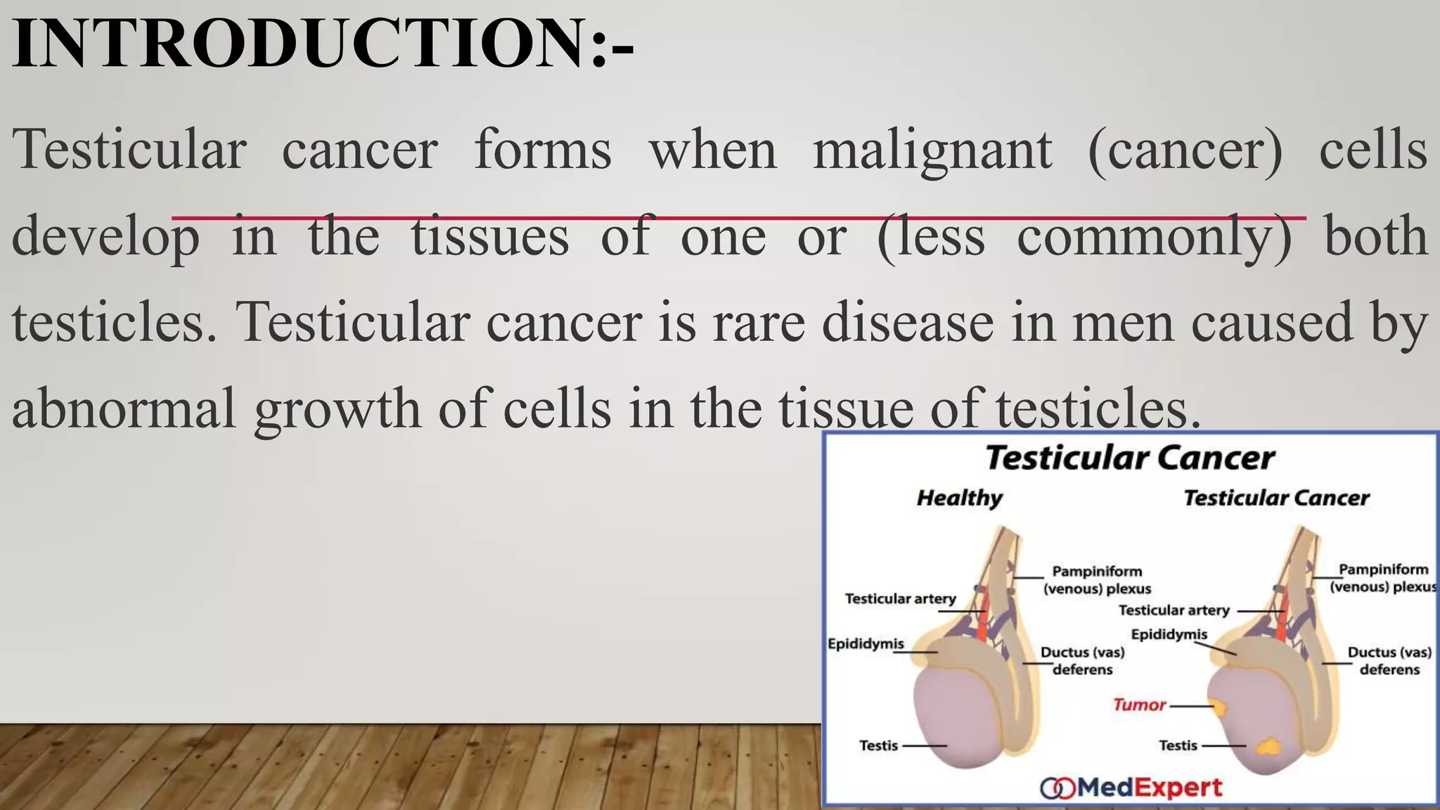 Testicular cancer.pptx
