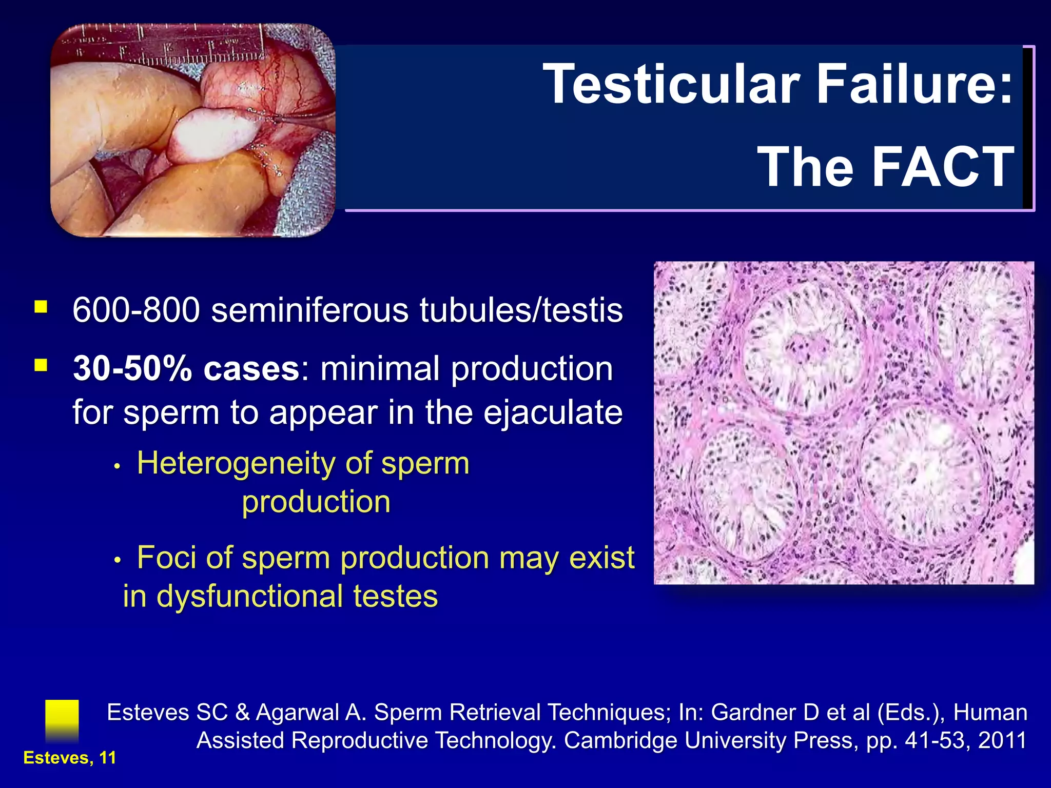 Testicular Failure and Male Infertility - New Insights and Evolution of ...