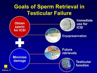 Testicular Failure and Male Infertility - New Insights and Evolution of ...