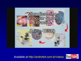 Testicular Failure and Male Infertility - New Insights and Evolution of ...