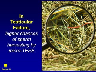 Testicular Failure and Male Infertility - New Insights and Evolution of ...