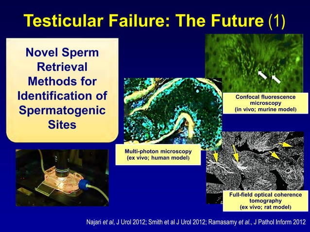 Testicular Failure and Male Infertility - New Insights and Evolution of ...