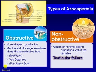 Testicular Failure and Male Infertility - New Insights and Evolution of ...