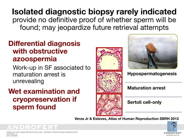 Testicular Failure in Humans: Current management and future ...