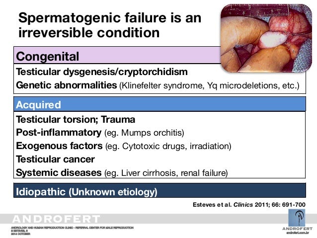 Testicular Failure in Humans: Current management and future perspecti…