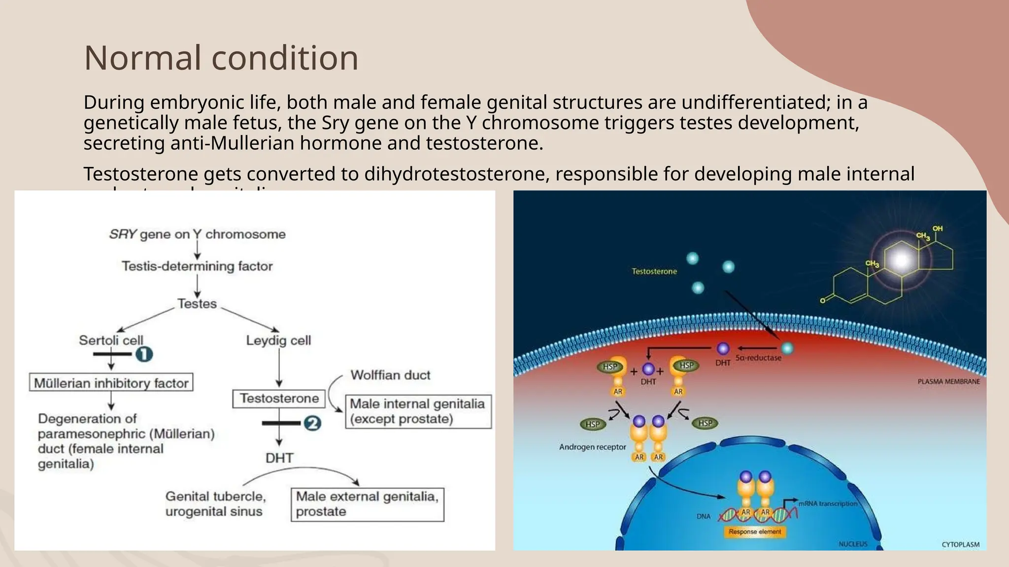 testicular feminization syndrome/ Androgen insensitivity syndrome | PPTX