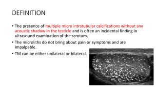 Testicular Microlithiasis.pptx