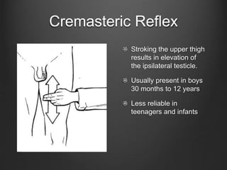 Testicular pain in emergency | PPTX