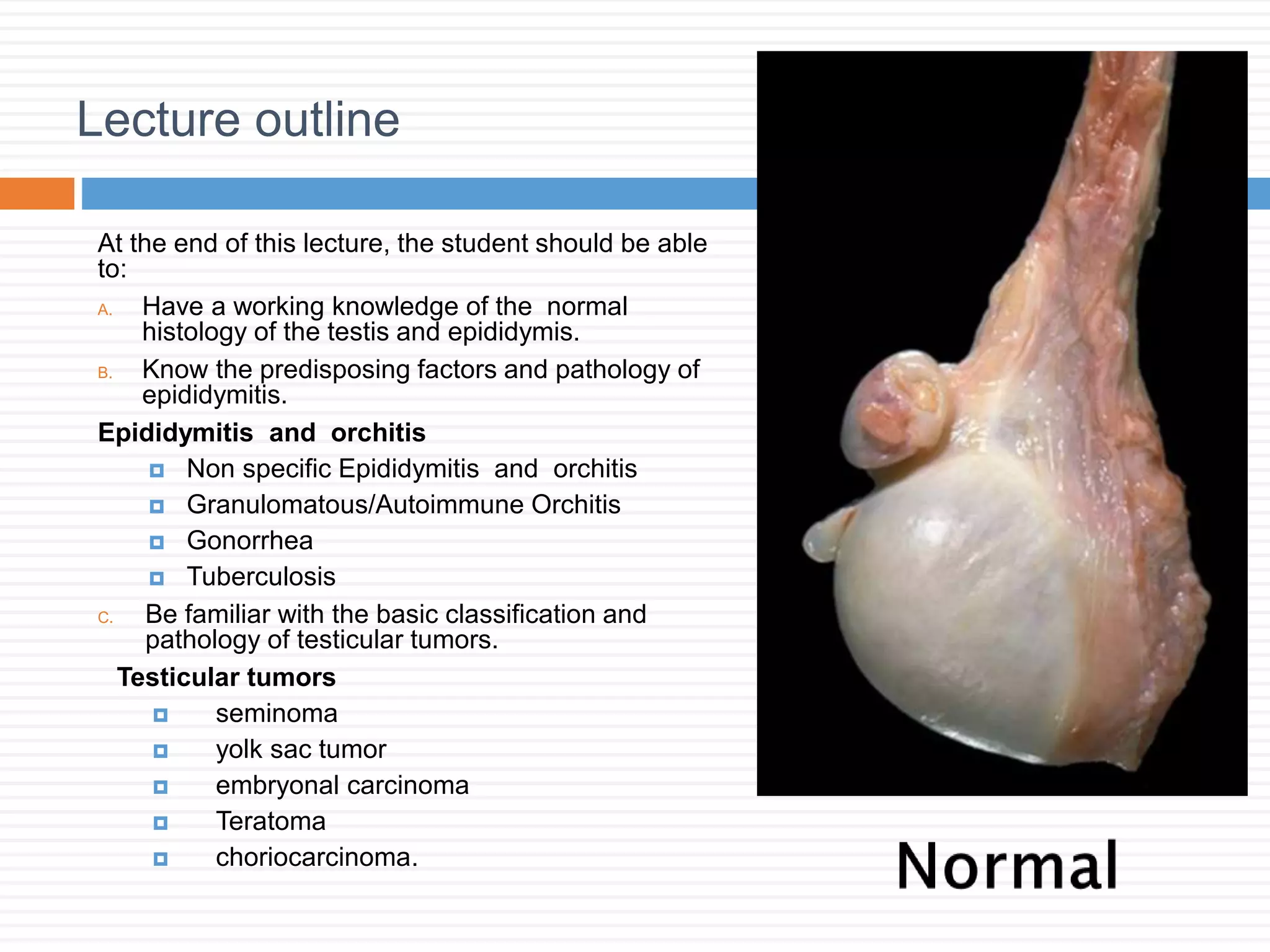Testicular Pathology Sufia Husain 2018 Ppt